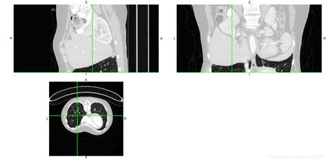 【5】nibabel三维显示orthoslicer3ddatatranspose1 2 0show Csdn博客