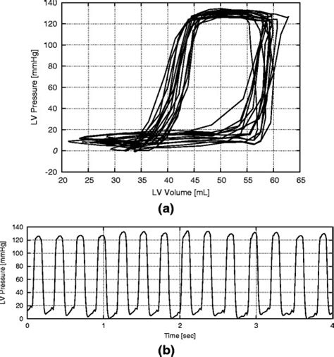 0A Four Second Sample Demonstrating A Distorted PV Loops B LV Pressure Download Scientific