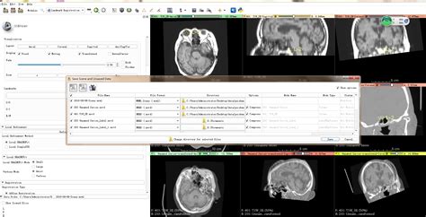 配准时遇到的ct和mr的坐标不同问题，请老师们指点 问题求助 3dslicer中文论坛