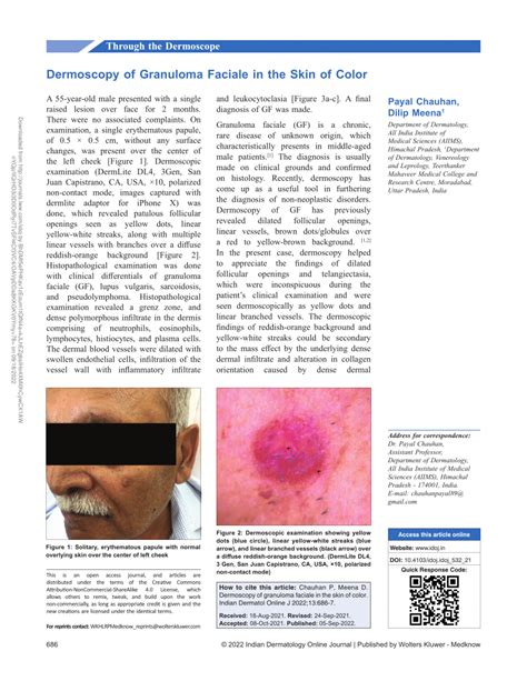 Pdf Dermoscopy Of Granuloma Faciale In The Skin Of Color
