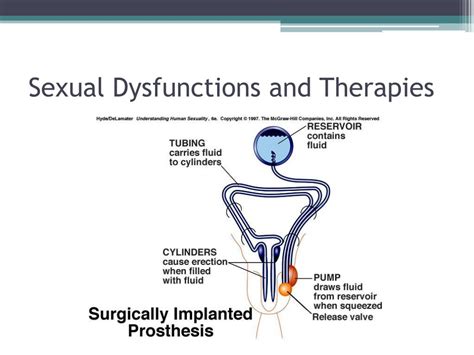 PPT Sex Differences And Defects PowerPoint Presentation Free Download ID