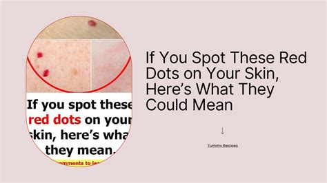 If You Spot These Red Dots On Your Skin Heres What They Could Mean
