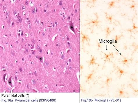 Pyramidal Neurons Cerebral Cortex