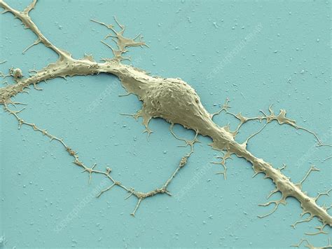 Stem Cell Derived Neuron Sem Stock Image C029 8216 Science Photo Library