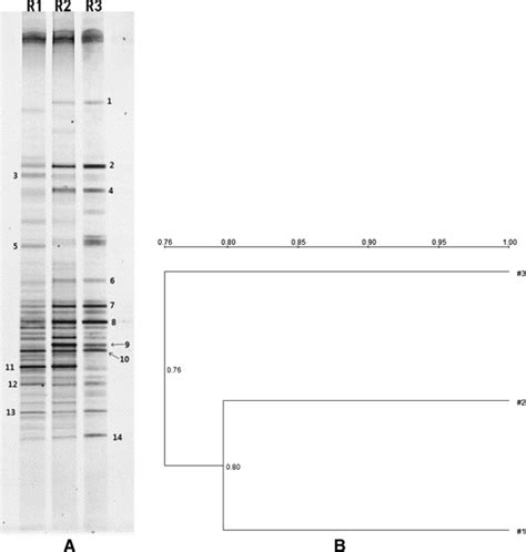 A Dgge Profiles Of Total Bacteria And B Cluster Analysis Of Sludge Download Scientific Diagram