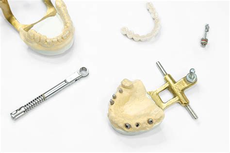 흰색 배경에 치과 임플란트가있는 흰색 세라믹 치아 토크 렌치와 치과 드라이버 임플란트에 대한 치과 이식 및 정형 외과 치과의 개념 치과 대치가 뒤틀리다 건강관리와 의술에