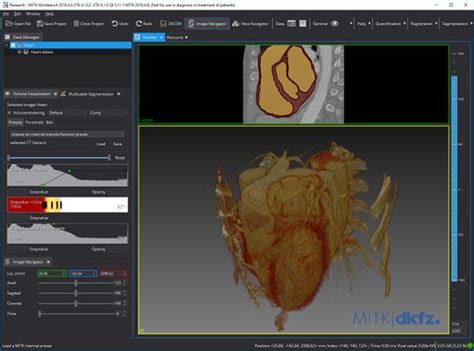 The Medical Imaging Interaction Toolkit Mitk