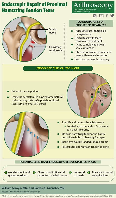 Proximal Hamstring Tendon Rupture