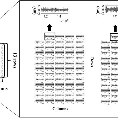 Electrode Placement Location In The Sole Of A Foot The Electrode Grid Download Scientific