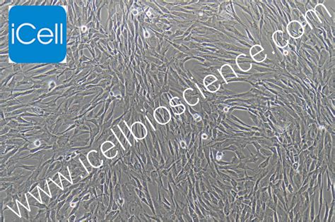 人原代子宫成纤维细胞 原代细胞 Str细胞 细胞培养基 镜像绮点生物