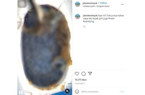 Dilihat Dari Mikroskop Lubang Speaker Earphone Simpan Kotoran Sebanyak Ini