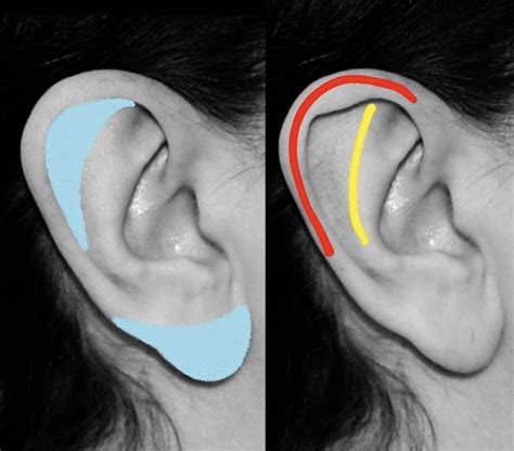 Scaphoid Fossa Piercing