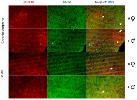 Sex Differences In Map Kinase Activation In The Periaqueductal Gray After Morphine Treatment Usu