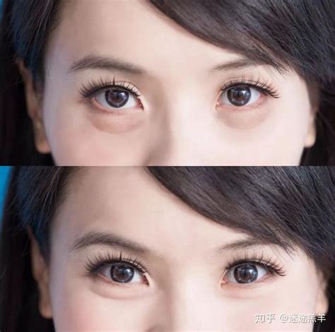 去眼袋的方法 六个小妙招轻松打造大眼睛 知乎