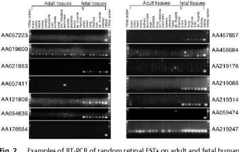 Figure 2 From A Computationalfunctional Genomics Approach For The Enrichment Of The Retinal