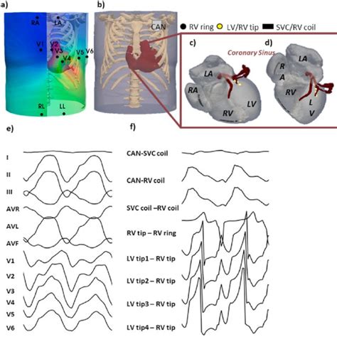 Example Of The Concept Behind Pace Mapping A Shows At Map For A Download Scientific Diagram