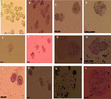 Images By Light Microscopy A Viable Green Protoscoleces After Staining