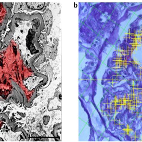 Mesangial Area Quantification Using Transmission Electron Microscopy Download Scientific