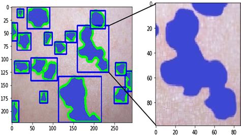Contour Finding Algorithm Applied To Output Of U Net Clusters Of