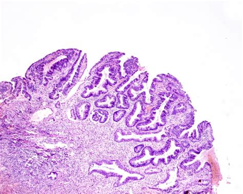 Low Magnification Image Of The Glandular Epithelium Of The Unstained