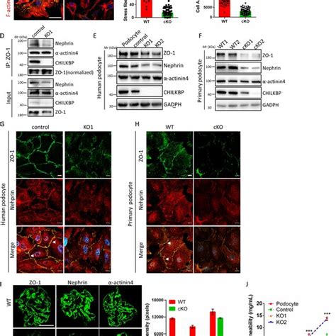 Podocyte Structure A Scanning Electron Microscope Image Of A