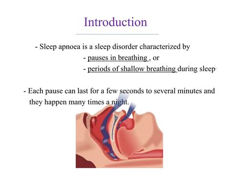 Role Of Mandibular Advancement Splint In Sleep Apnoea Pptx