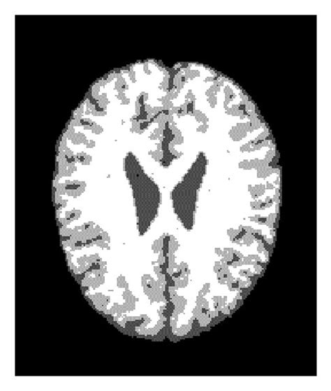 Antinoise Ability Comparison Of The Five Algorithms A Noisy Image