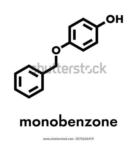 Monobenzone Over 12 Royalty Free Licensable Stock Illustrations