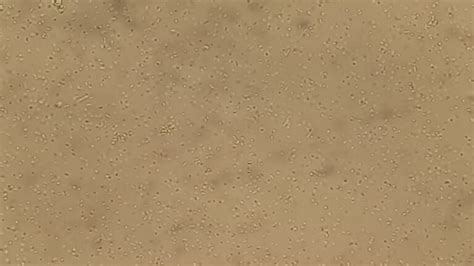 Citrobacter Werkmanii Introduction Morphology Pathogenicity Lab