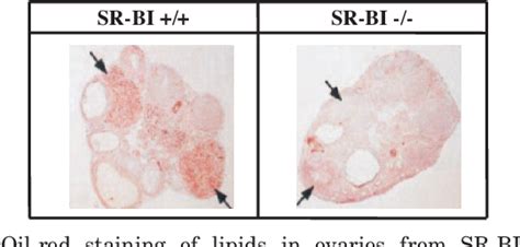 Figure 1 From The Molecular Control Of Corpus Luteum Formation Function And Regression