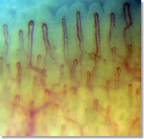 Dr Klopp Microscope Microcirculation What Is It History How It Work