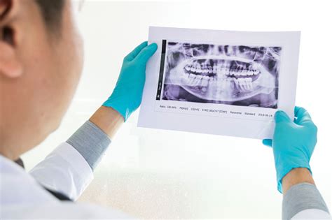 의사는 치 통 환자를 검사 하 고 의사는 치아를 치료 하 고 환자에 게 건강을 돌보고 약을 취할 준비를 하 라고 말했습니다 거울에 대한 스톡 사진 및 기타 이미지 Istock