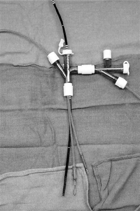 Double Bronchial Blocker Assembly In Series With Endo Download Scientific Diagram