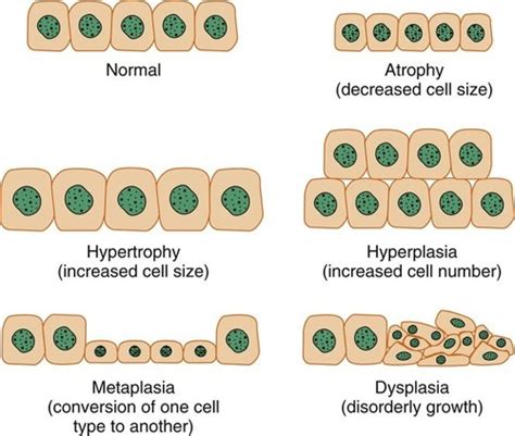 Cellular Adaptation Flashcards Quizlet