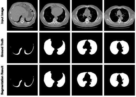 Segmentation Results Of The Proposed Method On Lung Dataset The