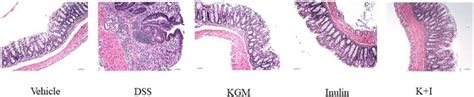 Histology Of The Distal Colon Of Vehicle And Dss Induced Mice Download Scientific Diagram
