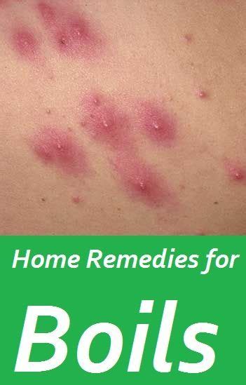 Boils Are Localized Skin Infection And Starts Are Red Spots On The Skin