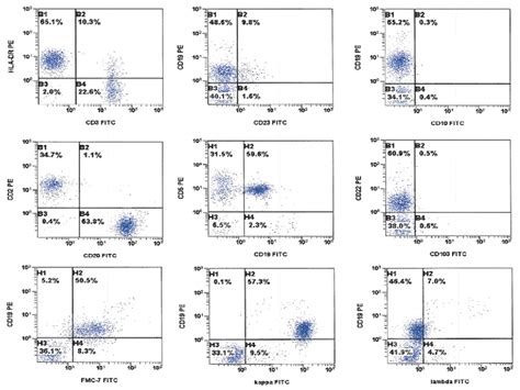 Flow Cytometry Of Peripheral Blood Shows Increased Abnormal B Cells Download Scientific Diagram