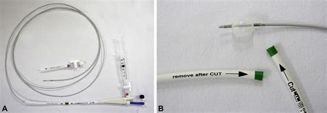 Access Balloon Catheter For Direct Peroral Cholangioscopy