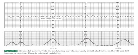 Postpartum Care Flashcards Quizlet