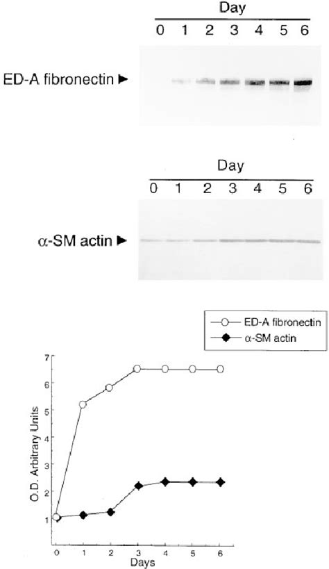 Figure 3 From The Fibronectin Domain Ed A Is Crucial For Myofibroblastic Phenotype Induction By
