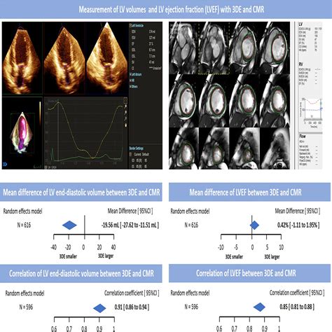 Left Ventricular Volume And Ejection Fraction Measurements By Fully