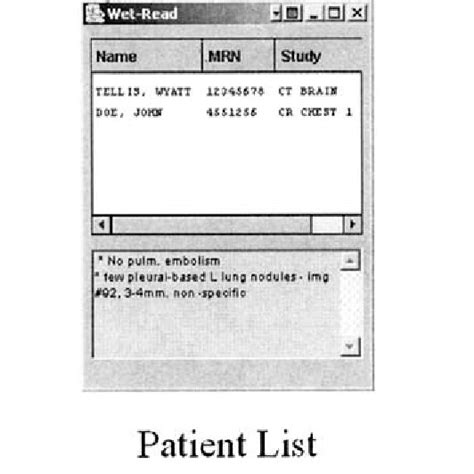 Personal Digital Assistant Gui Graphical User Interface Screens