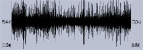 EEG Signal Of Hour Duration EEG Can Be Used For A Variety Of Medical Download Scientific
