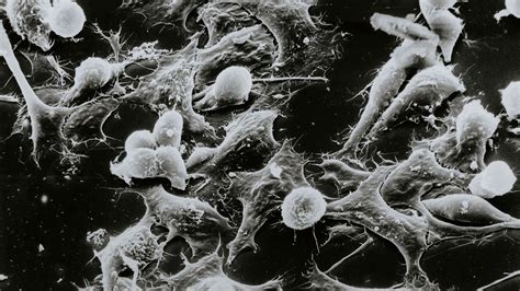 Tumor Metabolism Atlas Sheds Light On How Tumors Function Technology Networks