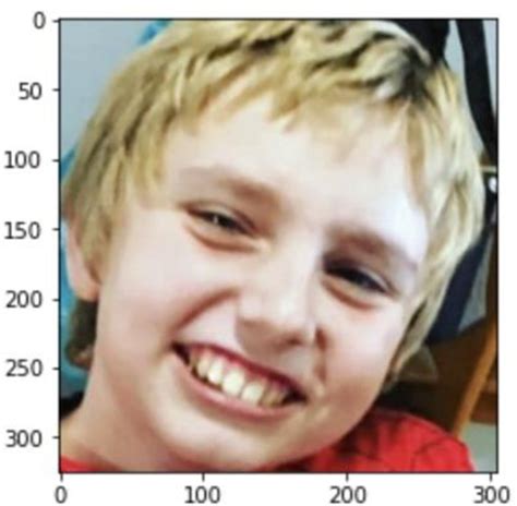 Figure 3 From Autism Spectrum Disorder Detection Using Facial Images And Deep Convolutional