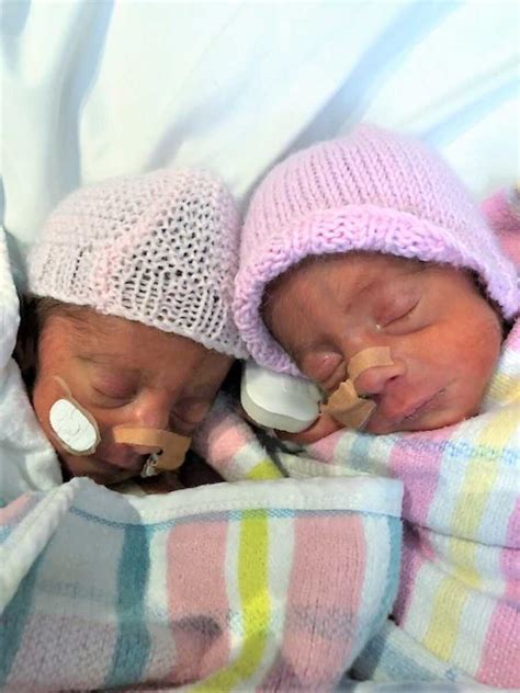 Woman Shares Mcda Twins Pregnancy Births Preemies With Twin To Twin Transfusion Syndrome Best