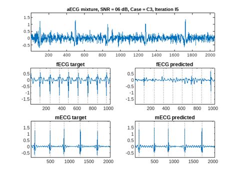 Signal Source Separation Using W Net Architecture Matlab And Simulink Mathworks 한국