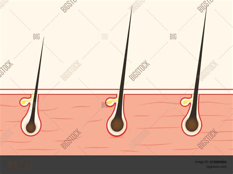 Hair Growing Concept Vector And Photo Free Trial Bigstock