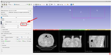 Step 2 Setting Up A Monai Label Slicer Module Nvidia Docs